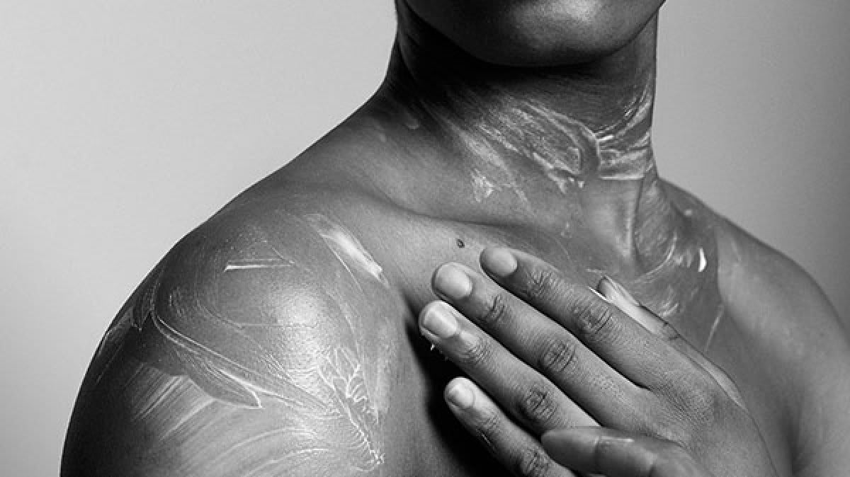 Hvorfor du får bumser på din ryg | Gents